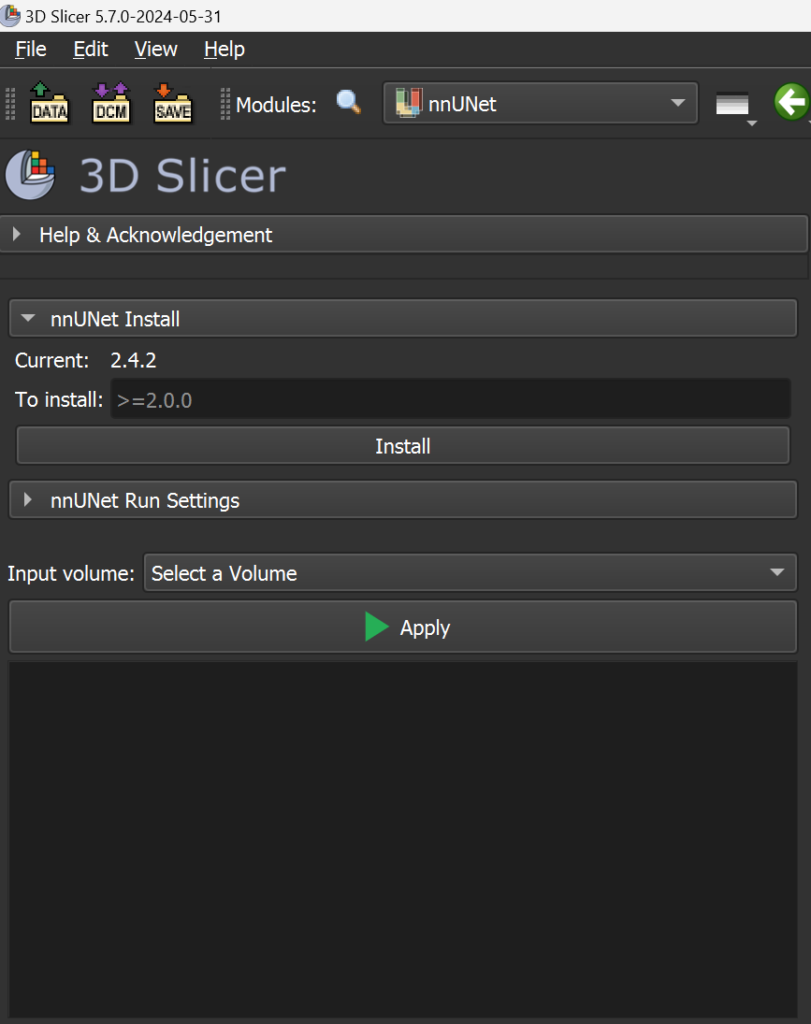 Automatic Spine Segmentation in Slicer - PYCAD - Your Medical Imaging ...