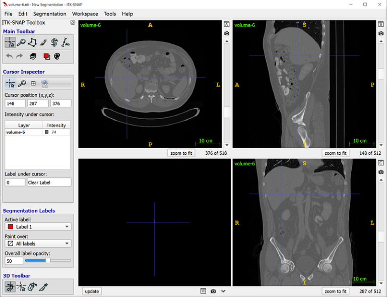 Software to Visualize/Annotate Dicom/Nifti files - PYCAD - Your Medical ...