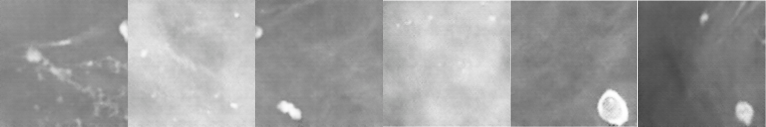 Generate Synthetic Medical Images with medigan | Python GAN Models ...